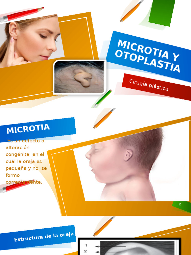 Microtia y Anotia: Opciones Quirúrgicas | PDF | Sistema Auditorio | Oído