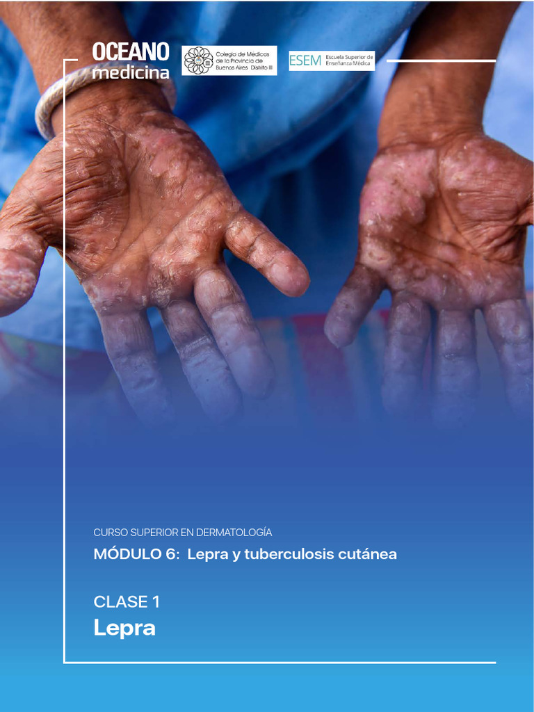 modulo 6 Clase 1-Lepra | PDF | Mycobacterium | Sistema inmune