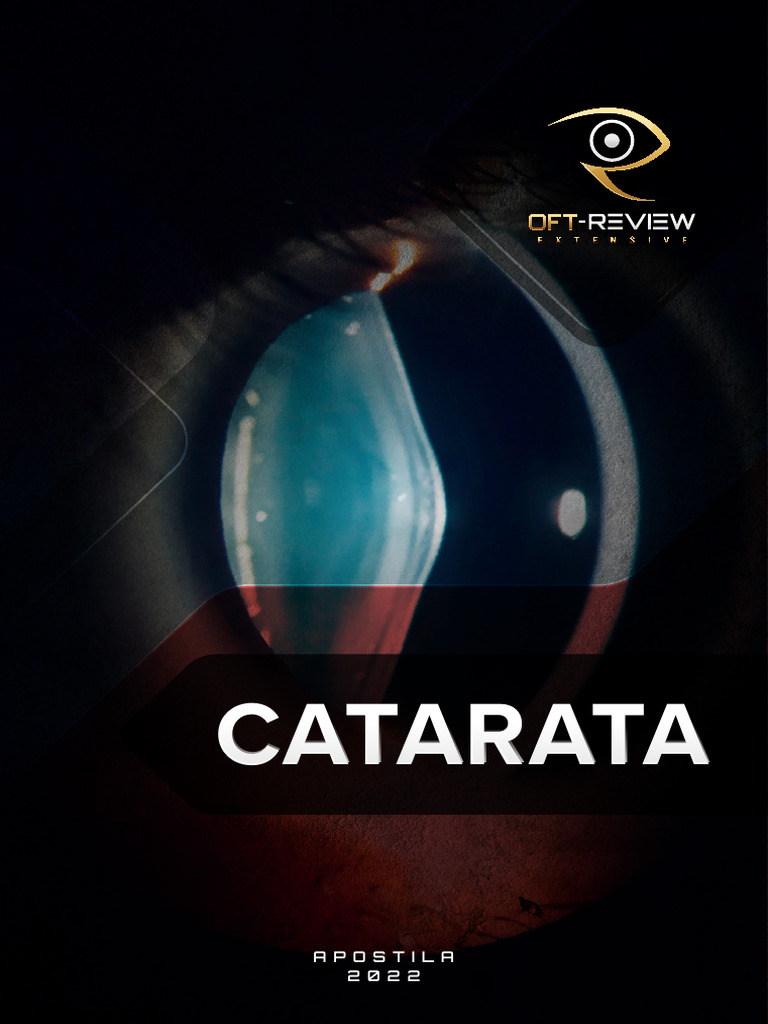 Oft Review+Extensive+Catarata | PDF | Célula (Biologia) | Proteínas