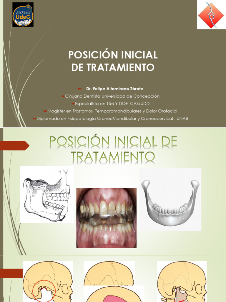 POSICIÓN INICIAL DE TRATAMIENTO ROMPE | PDF | Articulación | Odontología