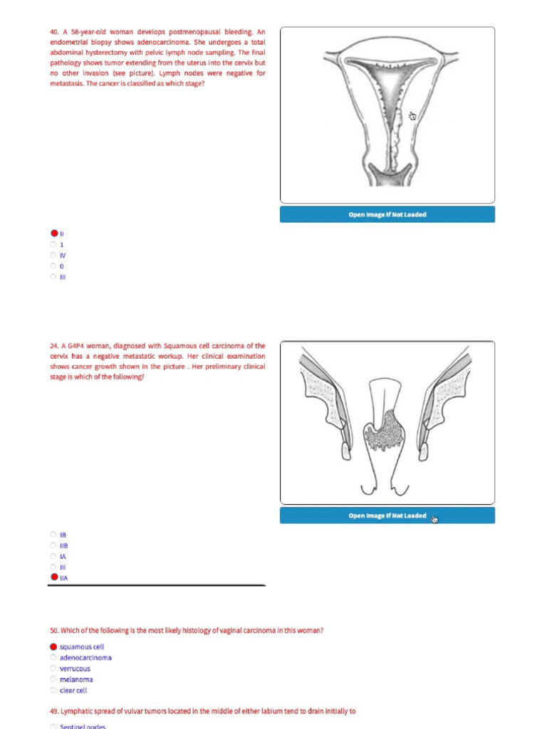 19 A Gyn Prefinal | PDF