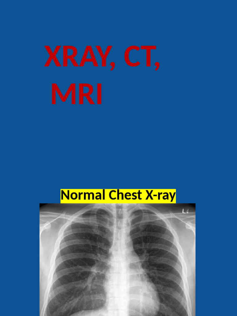 Pedia X Rays | PDF