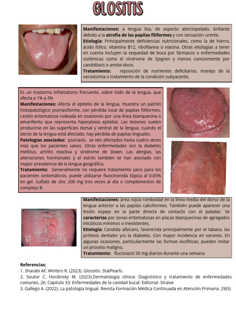 Glositis (1) | PDF | Medicina | Medicina CLINICA
