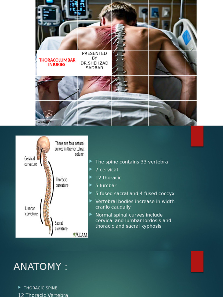 Thoracolumbar Injury Management Guide | PDF | Vertebral Column | Vertebra