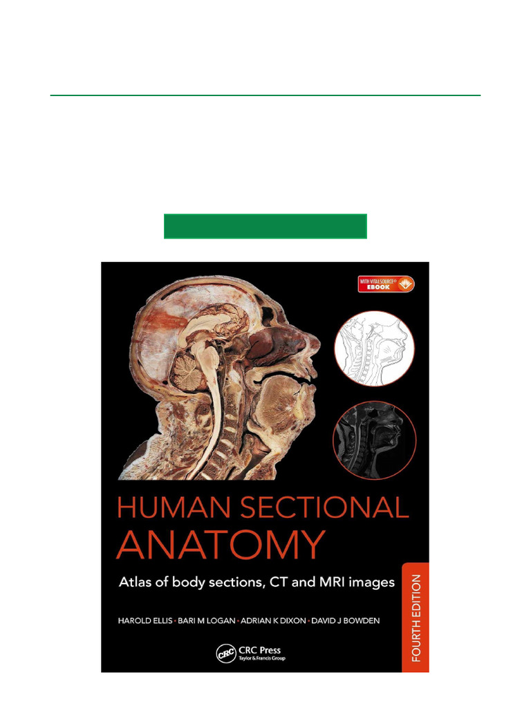 Human Sectional Anatomy Atlas of Body Sections, CT and MRI Images, Fourth Edition 4th Edition ...