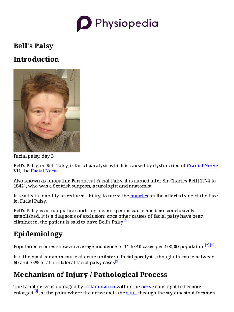 Bell's Palsy - Physiopedia | PDF | Human Anatomy | Neurology