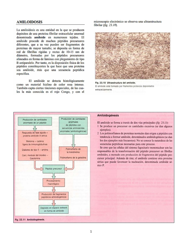 AMILOIDOSIS | PDF