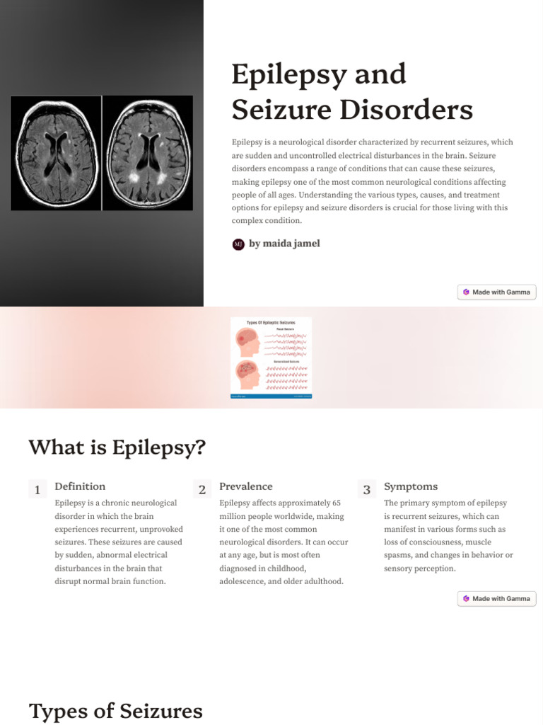 Genius and Temporal Lobe Epilepsy | PDF | Epilepsy | Neurology