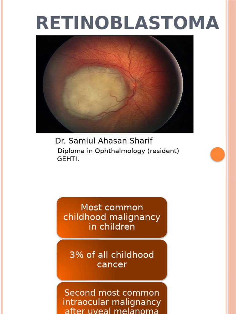 Retinoblastoma - DR - Sharif | PDF | Ophthalmology | Clinical Medicine
