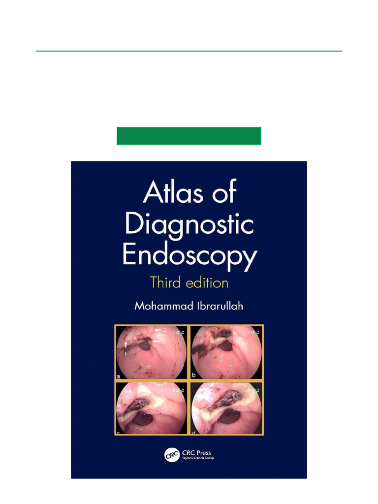 Atlas of Diagnostic Endoscopy, 3E - 3rd Edition PDF DOCX DOWNLOAD | PDF ...