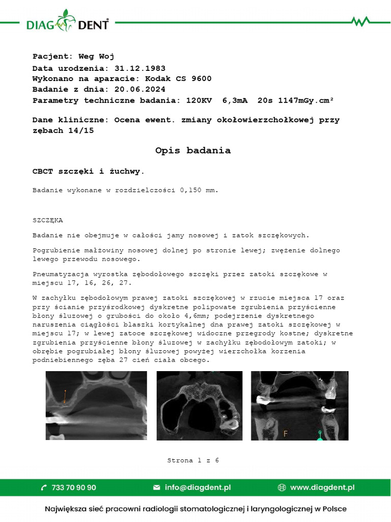Weg Woj | PDF