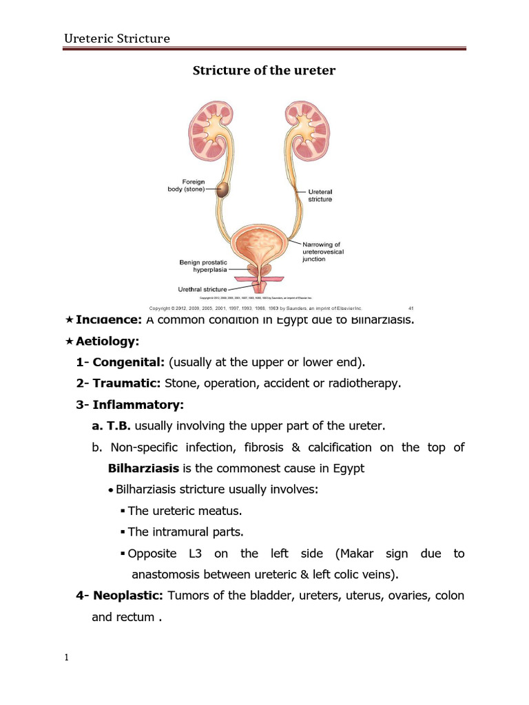 4 Urosurgery-Stricture Ureter | PDF | Medical Specialties | Urinary System
