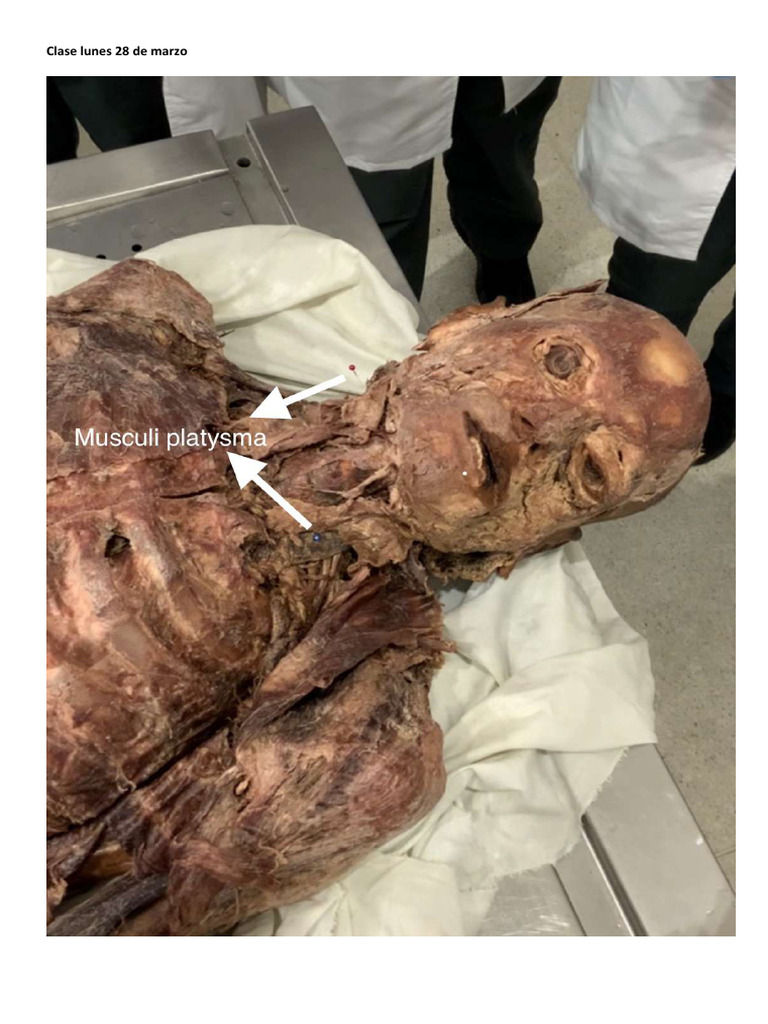 Músculos Cuello, Nuca, Dorso, Espalda y Plexo Braquial | PDF