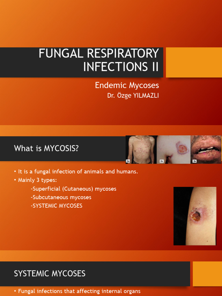 Arthrospores in Systemic Mycoses | PDF | Infection | Human Diseases And ...