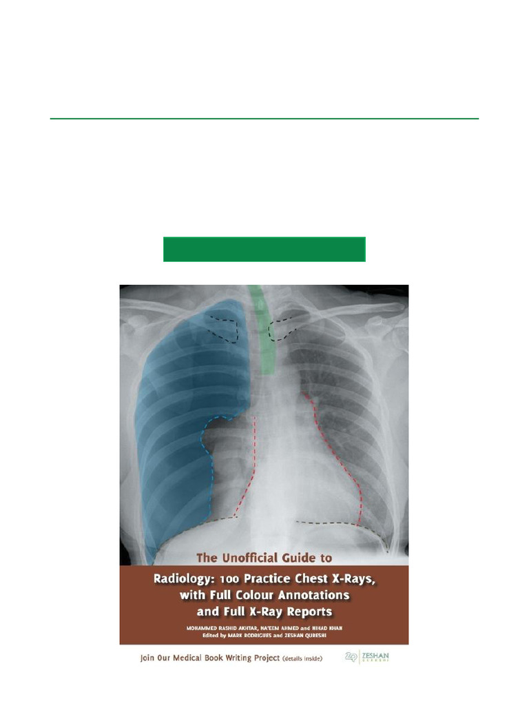 The Unofficial Guide to Radiology 100 Practice Chest X Rays, with Full ...
