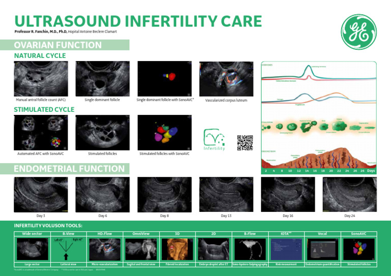 Jb21579xe Poster Infertility A3 2018 | PDF