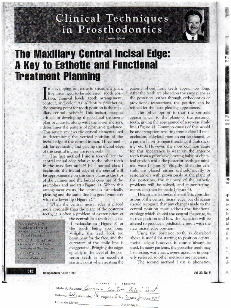 Spear The Maxillary Central Incisal Edge Is The Key 1999 | PDF