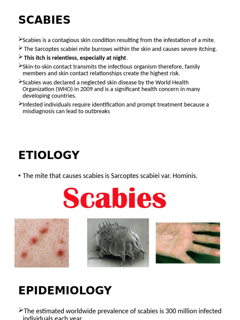 Understanding Scabies: Causes and Risks | PDF