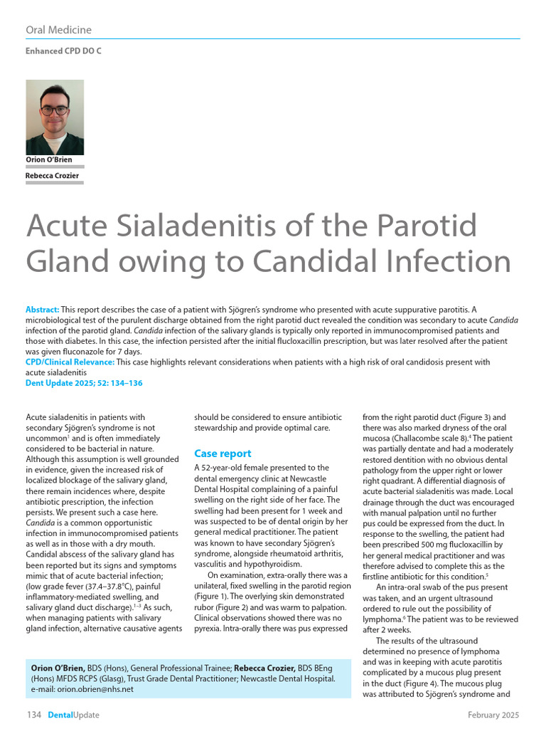 Acute Sialadenitis of The Parotid Gland Owing To Candidal Infection ...