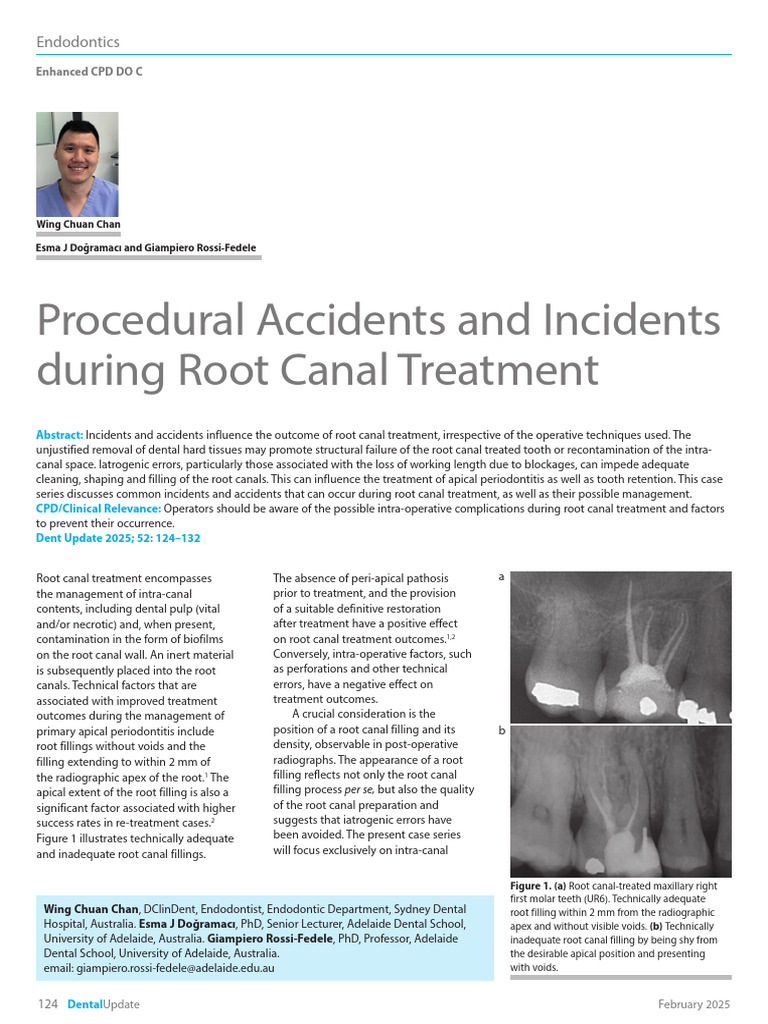 Procedural Accidents and Incidents During Root Canal Treatment | PDF ...
