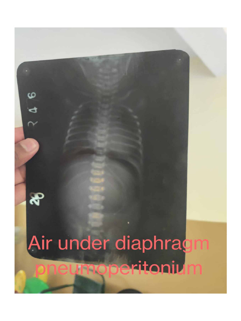 Paediatrics (X-Rays, Cereals and Instruments) | PDF