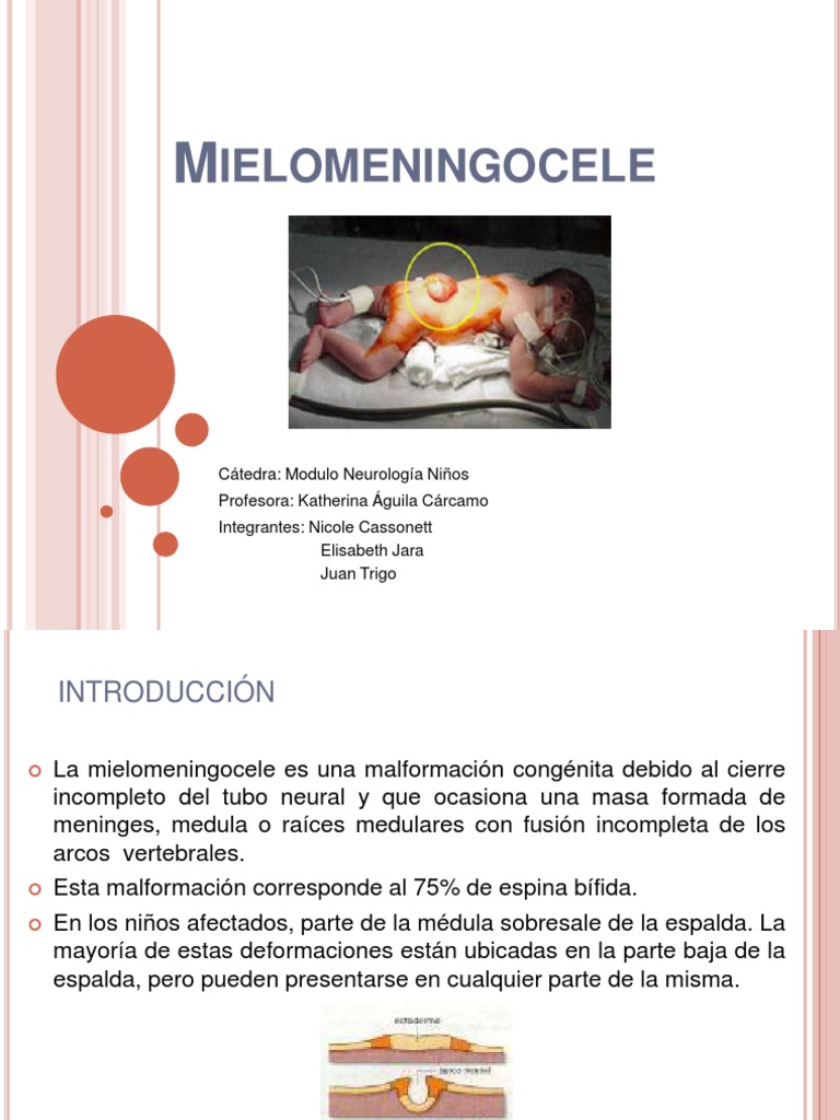 Mielomeningocele Final | PDF | Enfermedades y trastornos | Medicina CLINICA