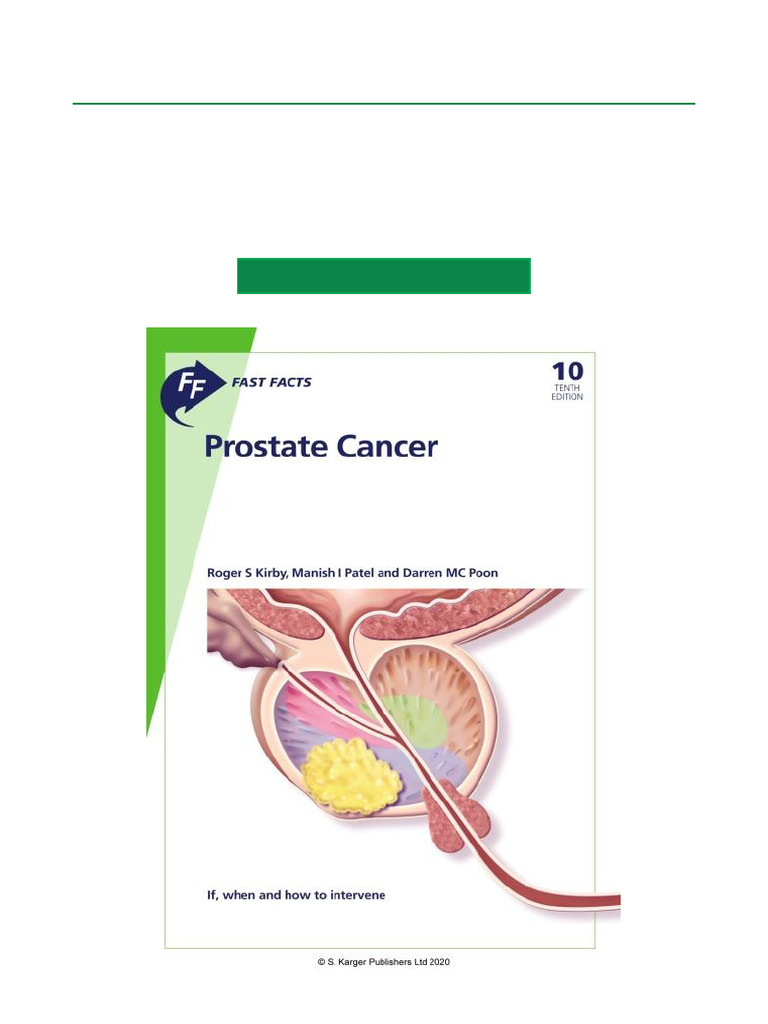 Fast Facts Prostate Cancer If, When and How To Intervene Full MOBI ...