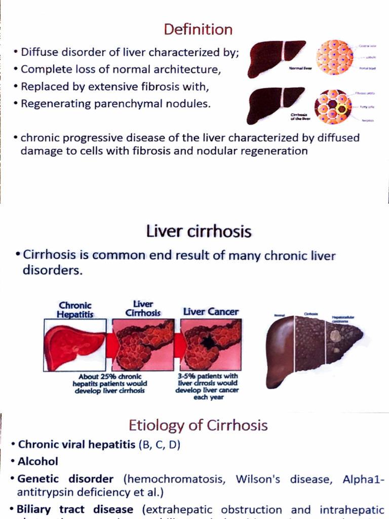 Liver Cirrhosis | PDF
