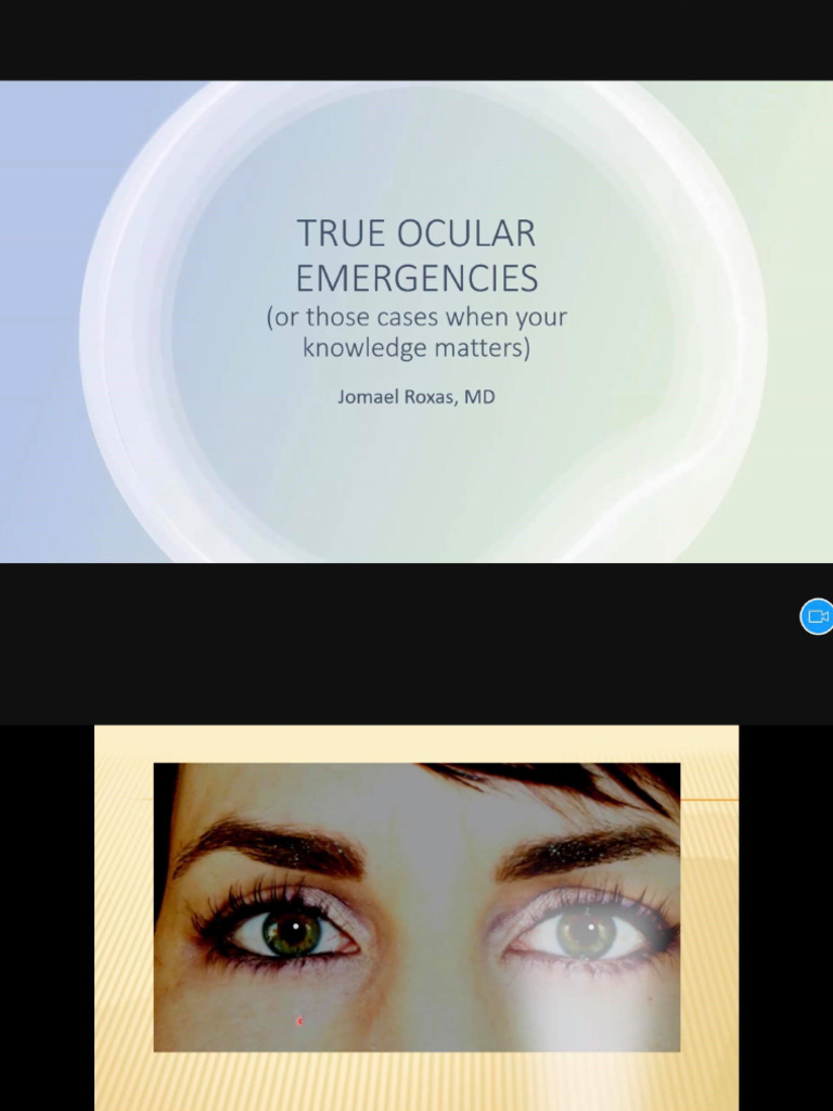 OCULAR EMERGENCIES by Dr. J. Roxas PDF | PDF