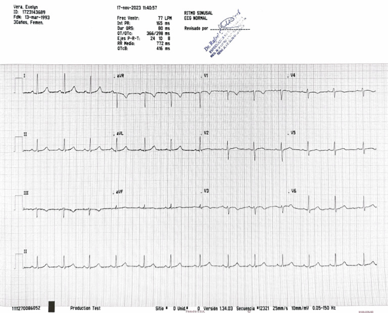 Ekg Vera | PDF