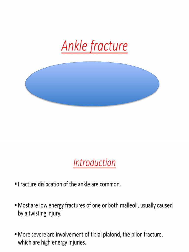Ankle Fractures | PDF