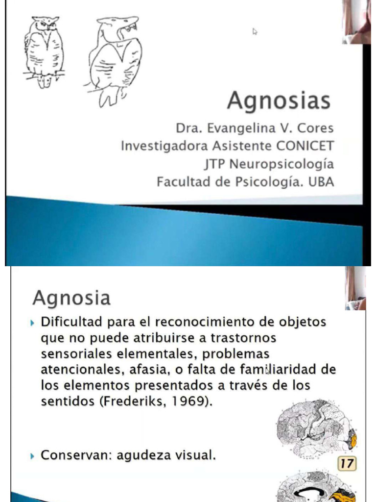 Agnosias PPT Parte 1 | PDF