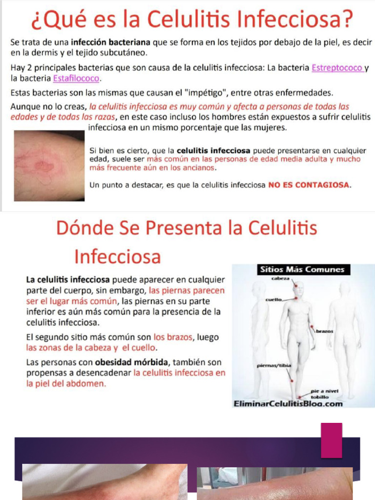 Signos de Celulitis y Linfangitis | PDF | Enfermedades y trastornos ...