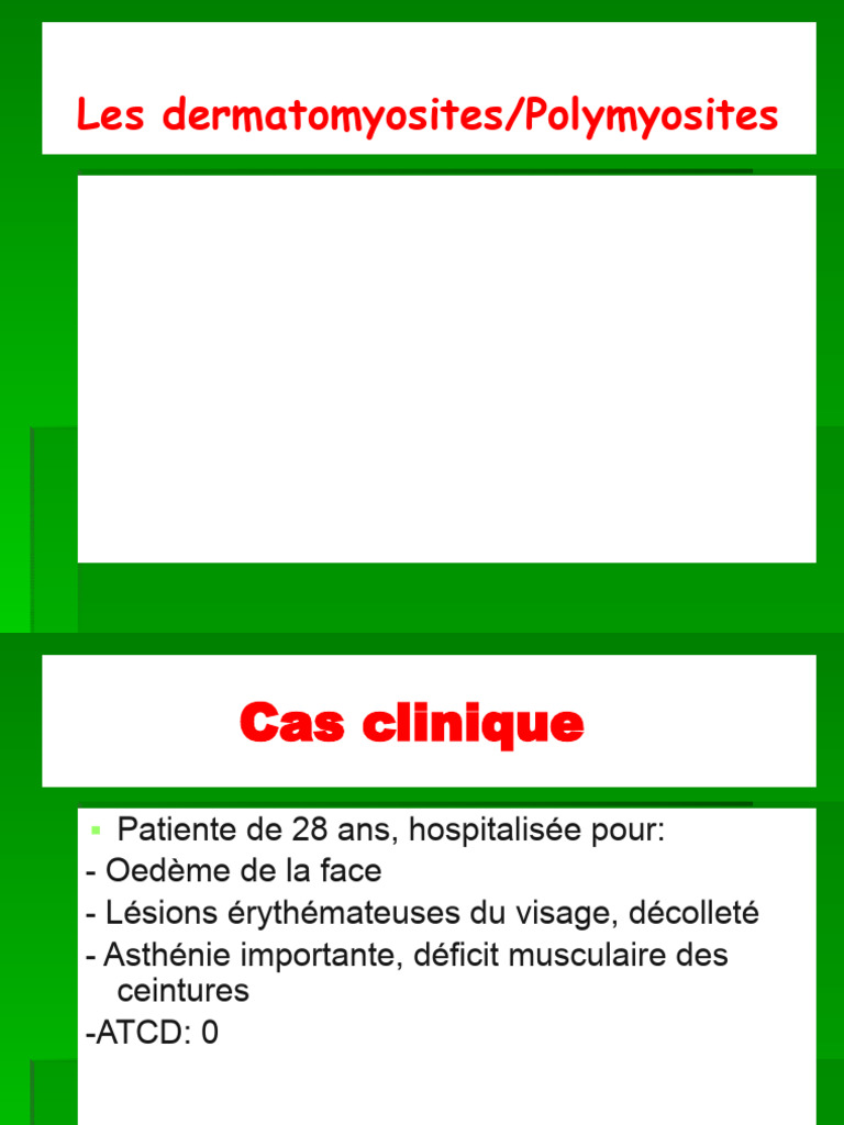 Dermatomyosites et Polymyosites: Cas Clinique | PDF | Cancer | Maladies ...