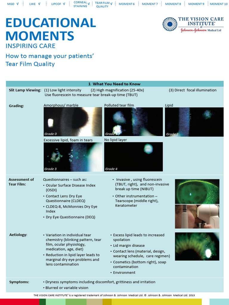 Educational Moment - 5 - Tear Film Quality | PDF | Contact Lens | Human Eye