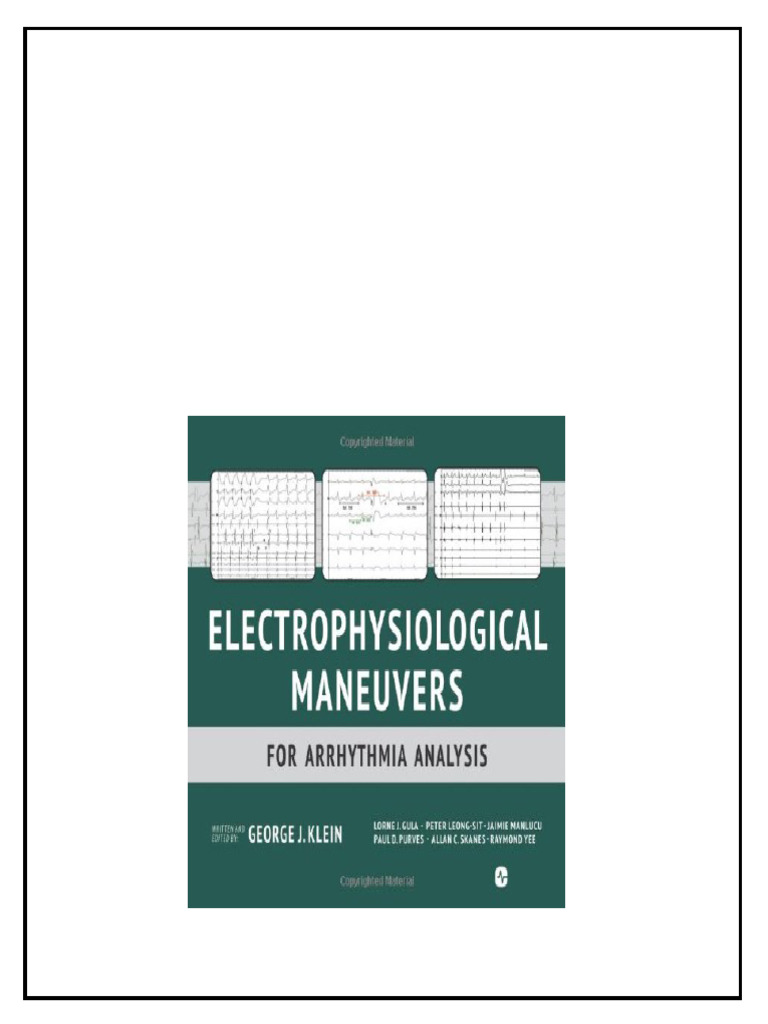 (Ebook) Electrophysiological Maneuvers for Arrhythmia Analysis by ...