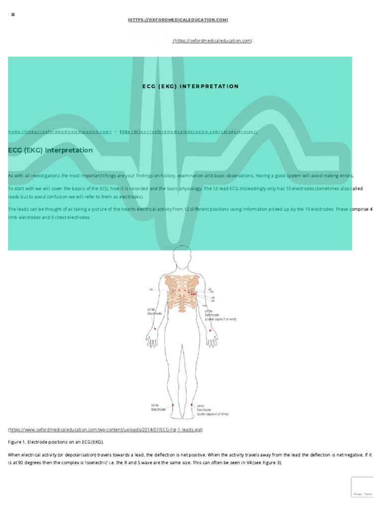 ECG Interpretation Basics and Techniques | PDF | Electrocardiography ...