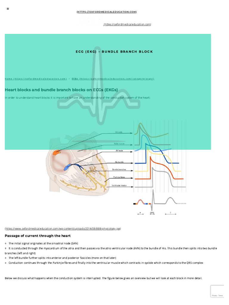 ECG (EKG) - Bundle Branch Block - Oxford Medical Education | PDF ...