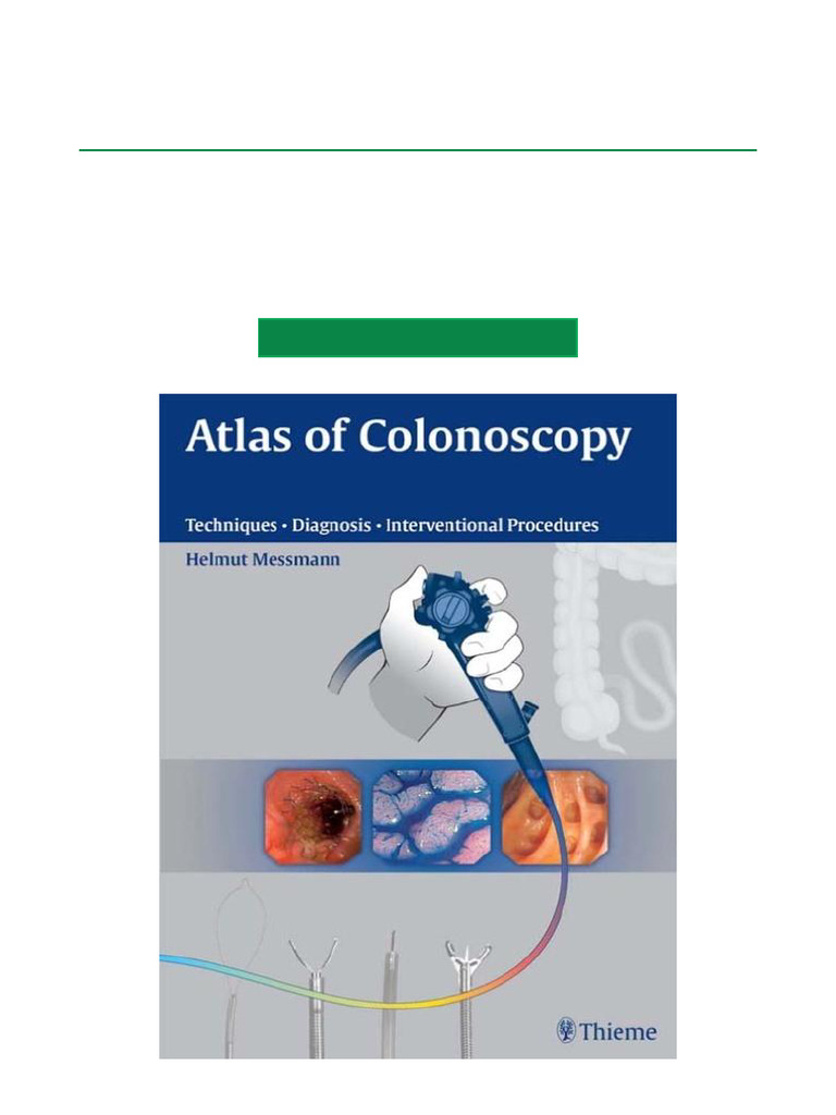 Atlas of Colonoscopy Techniques | PDF | Inflammatory Bowel Disease ...