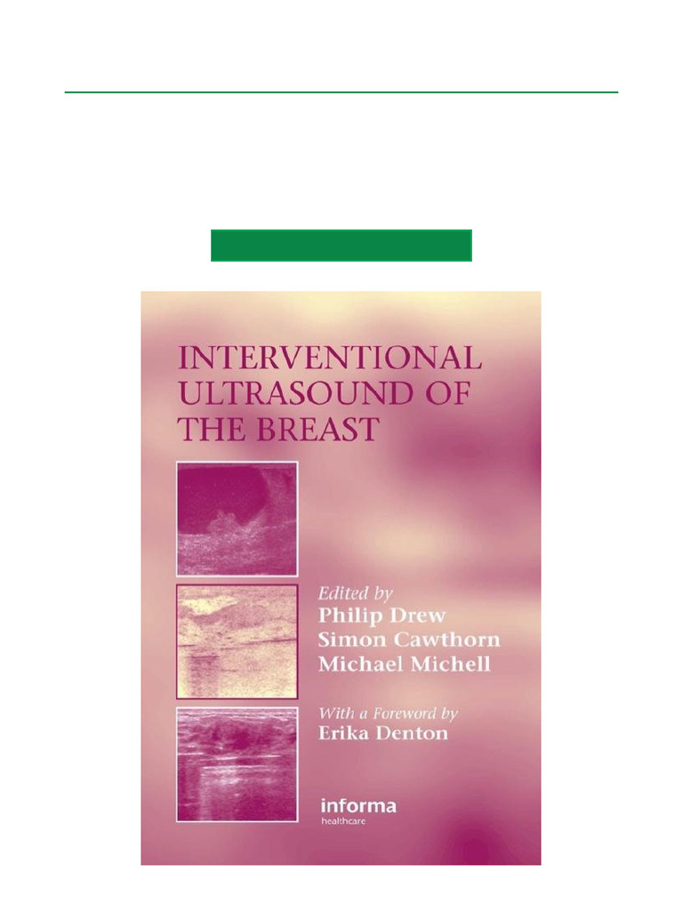 Interventional Ultrasound of The Breast, 1st Edition Full Book Access ...