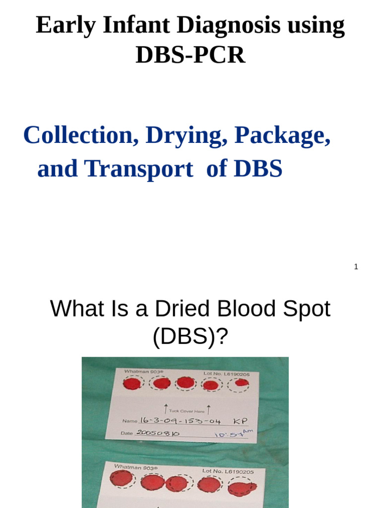 DBS Sample Collection for EID Testing | PDF