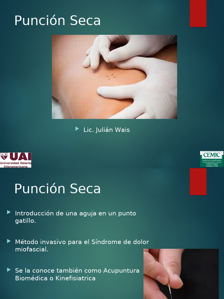 Punción Seca: Técnica y Aplicaciones | PDF | Acupuntura | Dolor