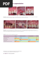 Periodontal Screening and Recording (PSR) System: Criteria For ...