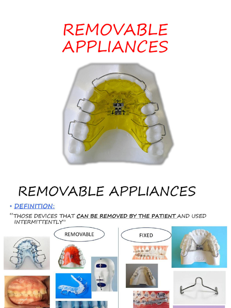 Passive Removable Appliances Overview | PDF | Orthodontics | Dentistry ...