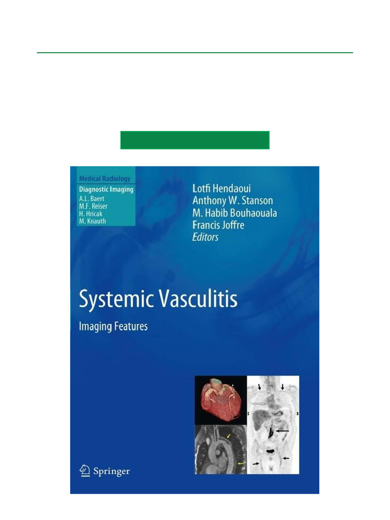 Systemic Vasculitis Imaging Features | PDF | Tunis | Blood Vessel