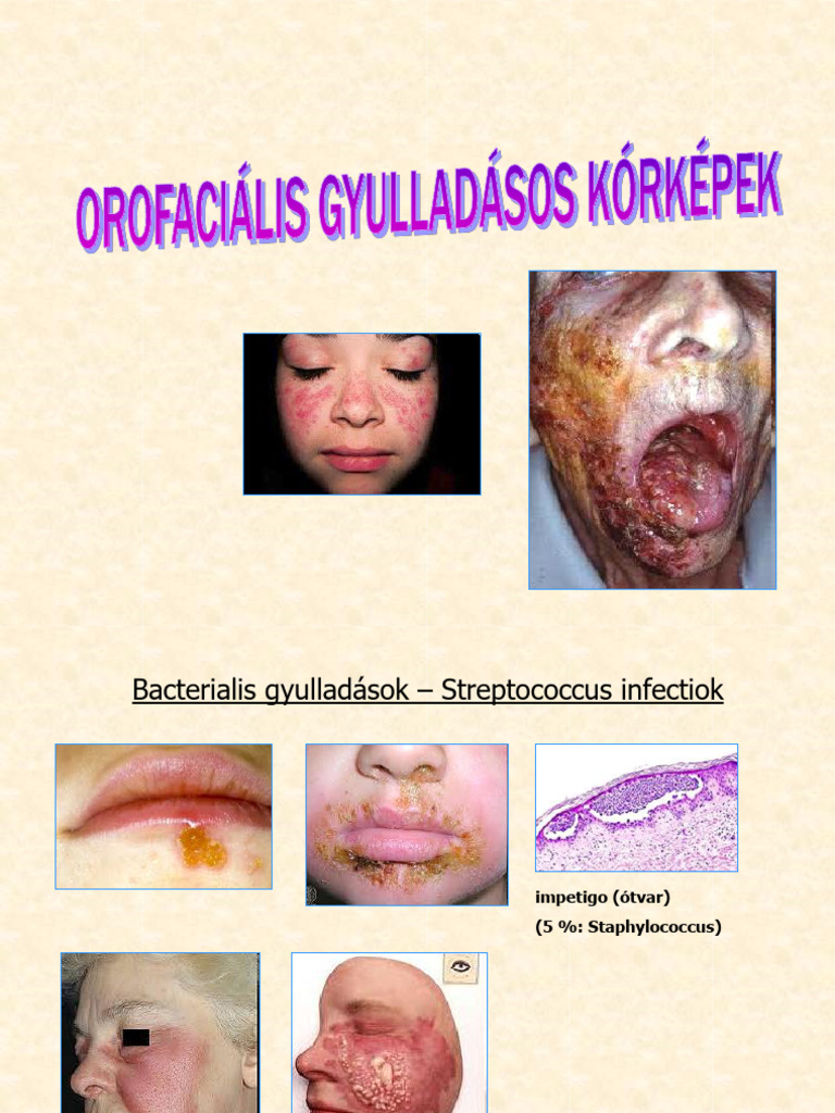 FOK-OrofacialGyull ZA | PDF