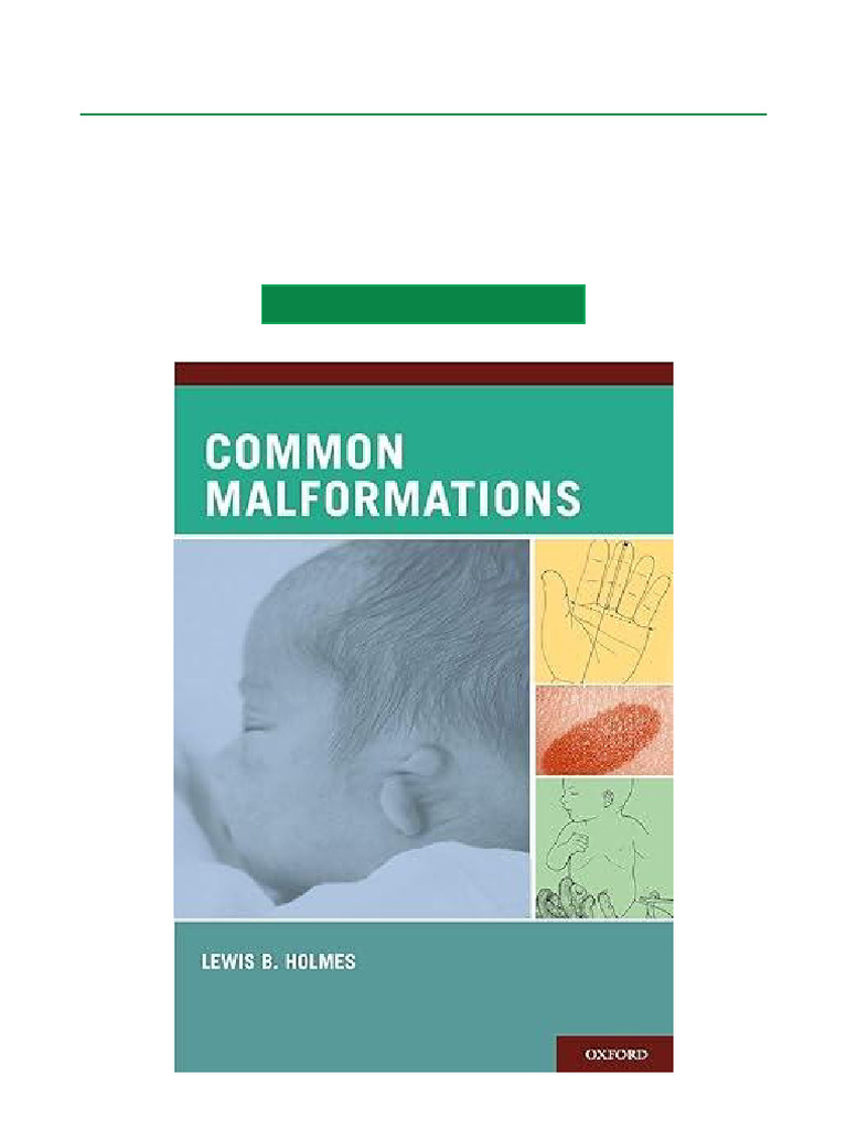 Common Malformations Updated Edition Download | PDF | Pregnancy ...