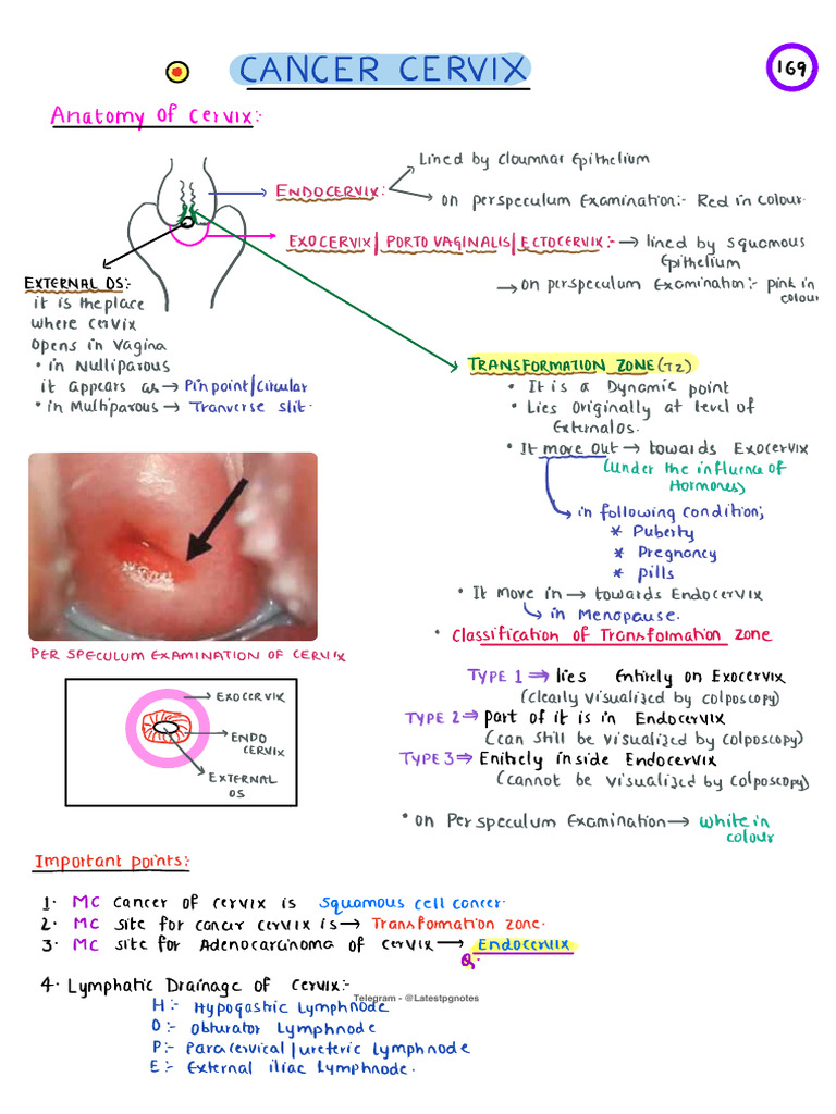 Ca Cervix | PDF