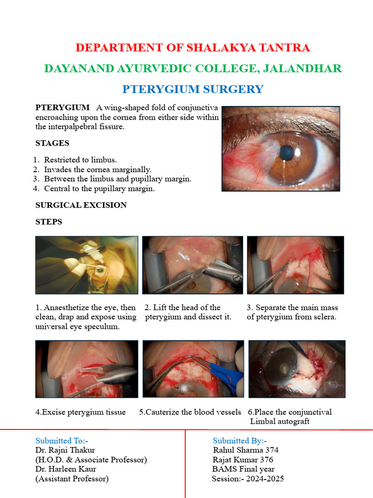Pterygium Surgery | PDF