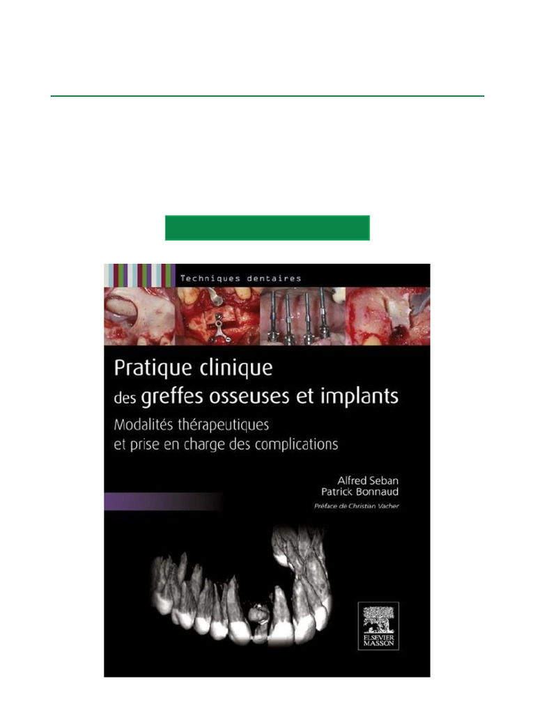 Greffes osseuses et implants : guide pratique | PDF | Implant dentaire ...